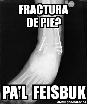Meme Personalizado - fractura de pie? pa'l feisbuk - 1322681