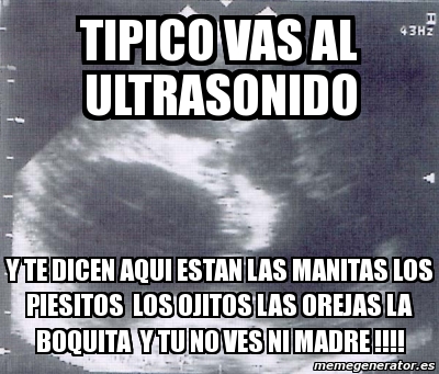 Meme Personalizado - tipico vas al ultrasonido y te dicen aqui estan ...