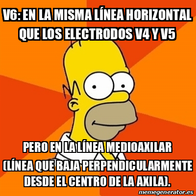 Meme Homer - V6: En la misma línea horizontal que los electrodos V4 y ...
