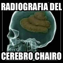Meme Personalizado - Radiografia del cerebro chairo - 33277770